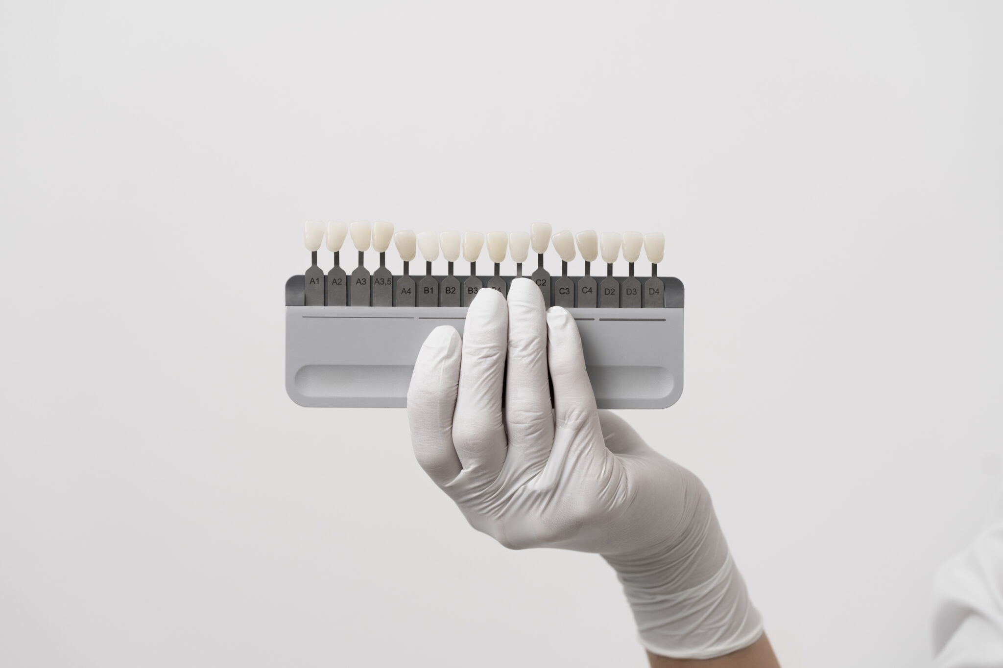 Vale a pena colocar facetas de porcelana? - Clinica Rejuvenesce